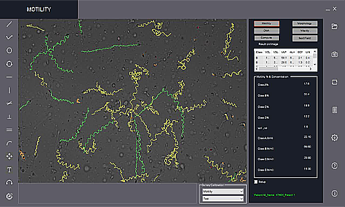 Computer Aided Semen Analysis (CASA) using Artificial intelligence ...