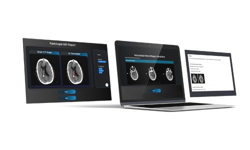 CT-Brain AIMedic - AICTEXPO