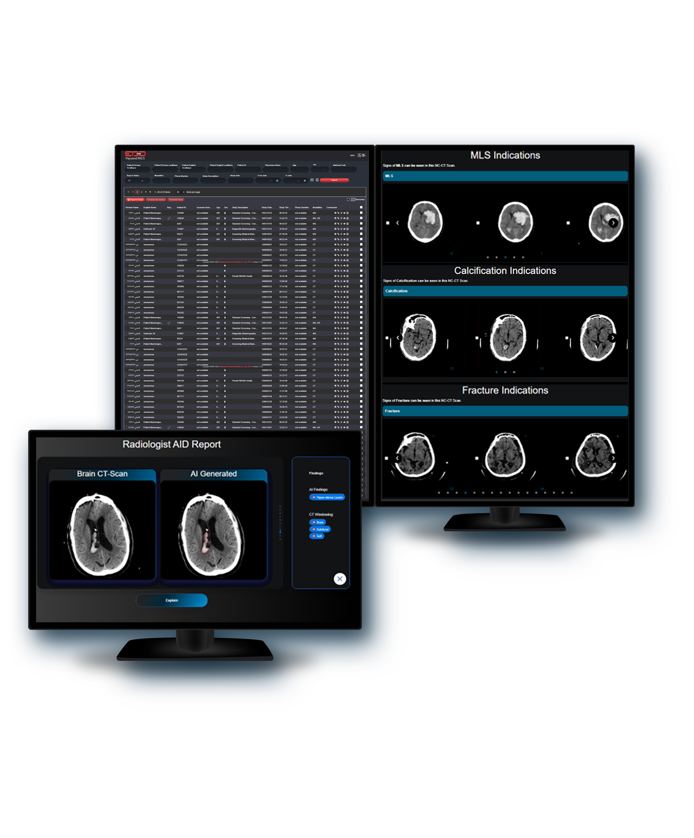 CT-Brain AIMedic - AICTEXPO