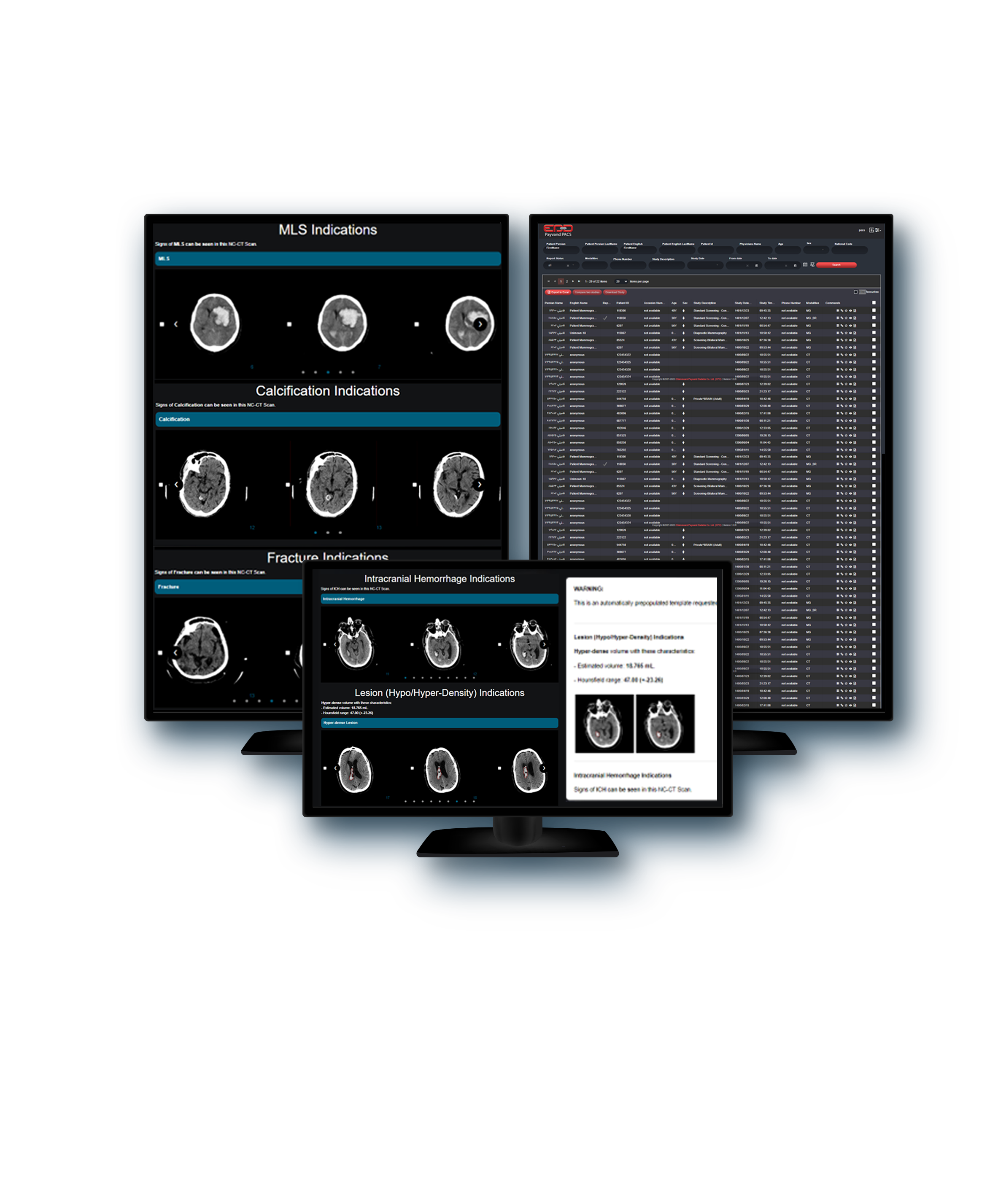 CT-Brain AIMedic - AICTEXPO
