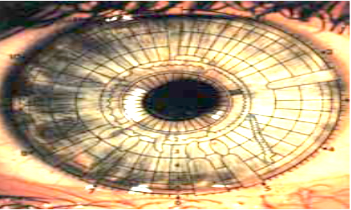 Eye imaging system with medical application - AICTEXPO